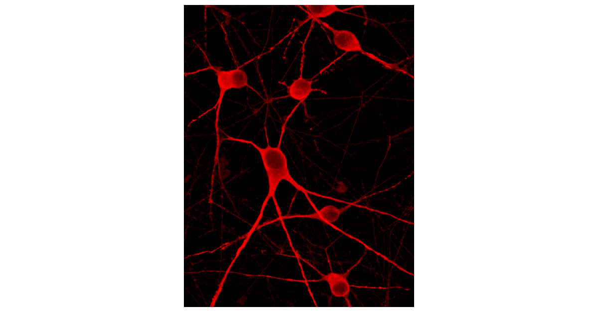 bit.bio further expands ioCells™️ range with early access launch of ...