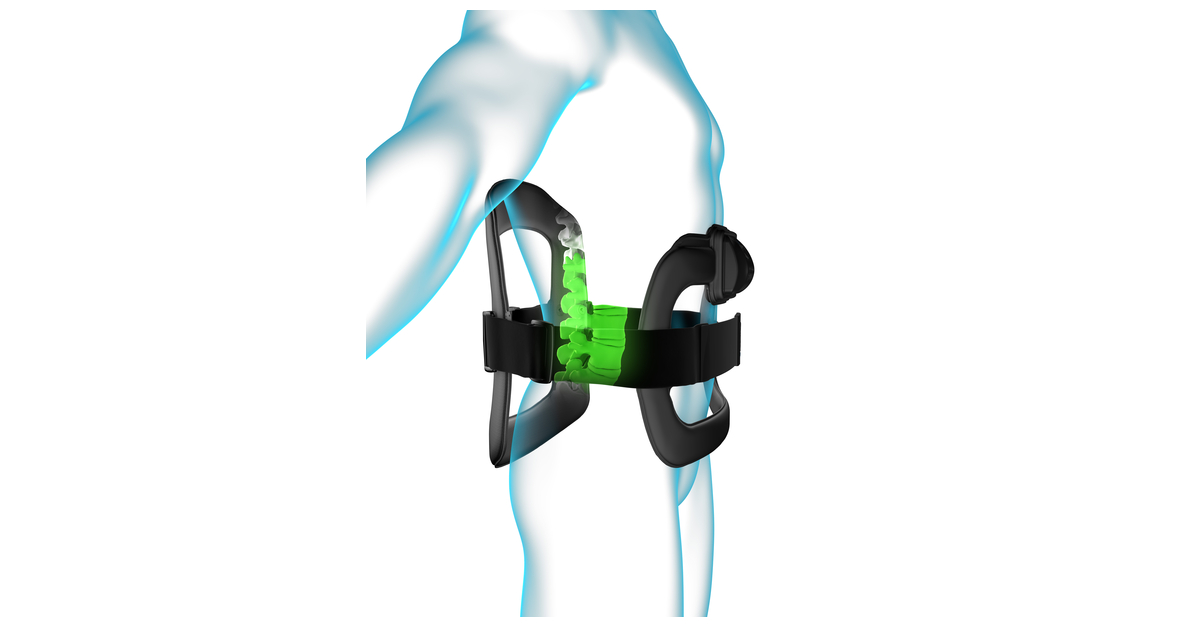Orthofix Announces Publication of New Data Supporting Use of PEMF ...