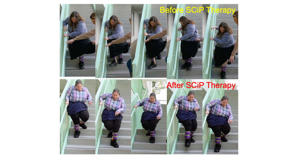 SpineX Announces Successful in-Human Results to Treat Adults with ...