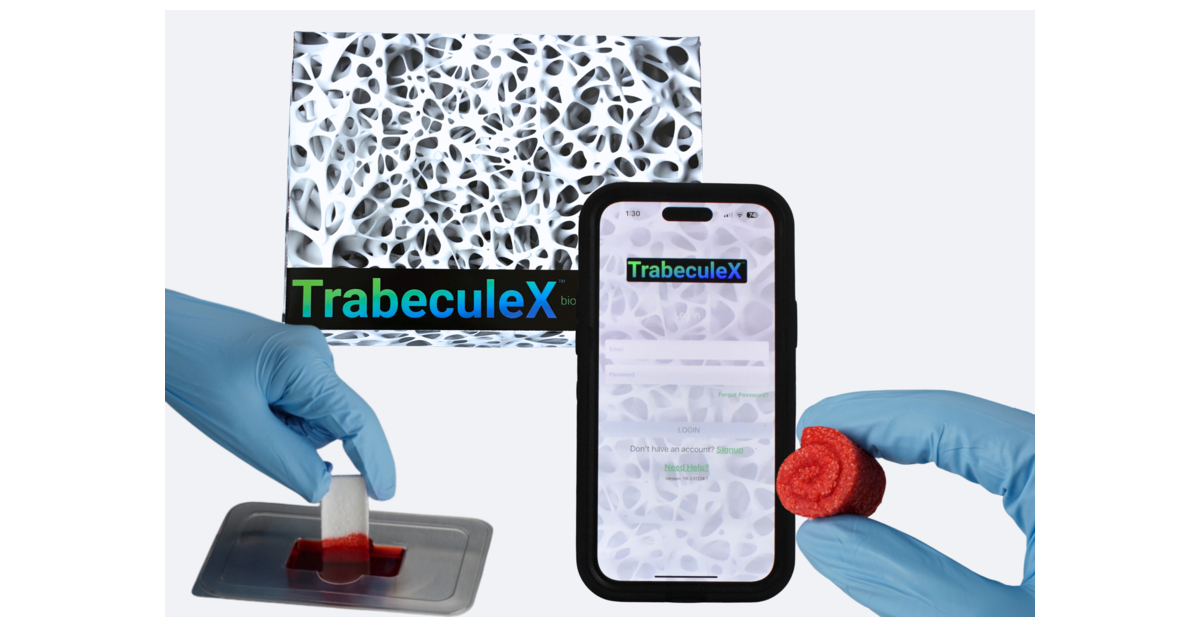 Xenco Medical presenta TrabeculeX Continuum, una innovadora ...