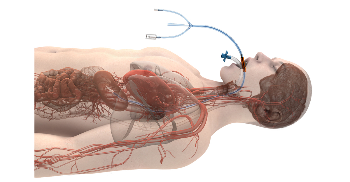 Attune Medical® Announces Support of AF Symposium 2024 | Business Wire