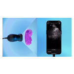 Butterfly Network Launches Next-Generation Butterfly iQ3™ in the United ...