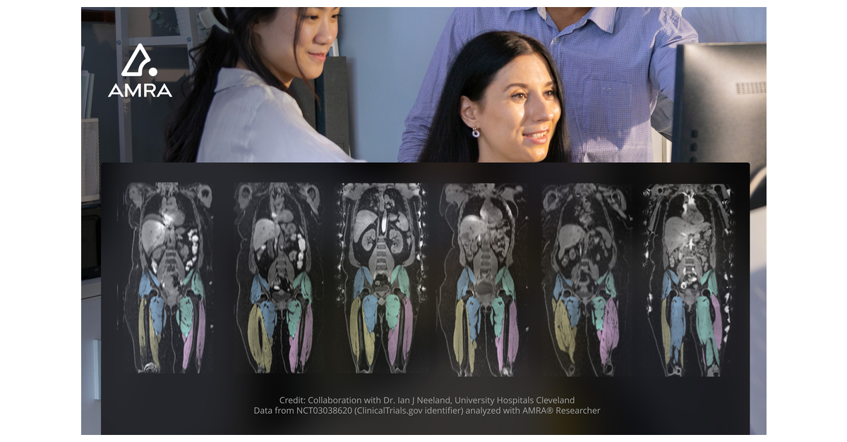 L'analyse de la composition musculaire d’AMRA Medical utilisée pour ...