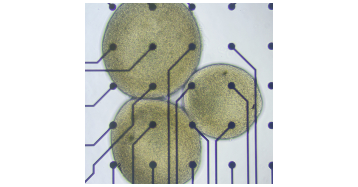 FinalSpark Launches the First Remote Research Platform Using Human ...