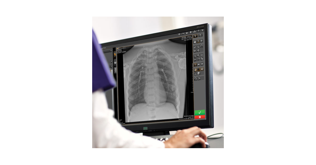 Carestream bringt die Software Image Suite MR 10 auf den Markt, um die ...