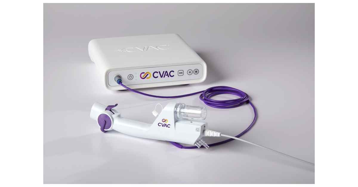Calyxo Announces New ASPIRE 1-Year Study Results with CVAC System in ...