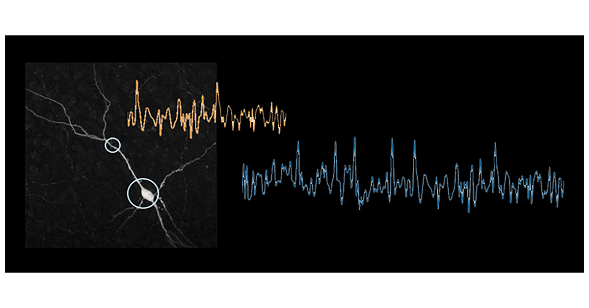 Bruker Introduces Innovative Neuroscience Research Solution with High ...