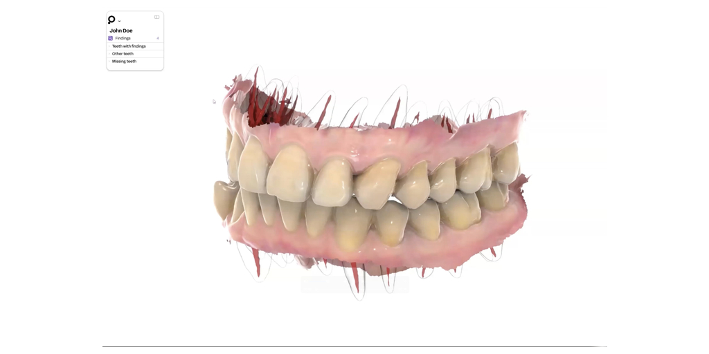 Perceptive Completes Successful Clinical Study of World’s First 3D ...