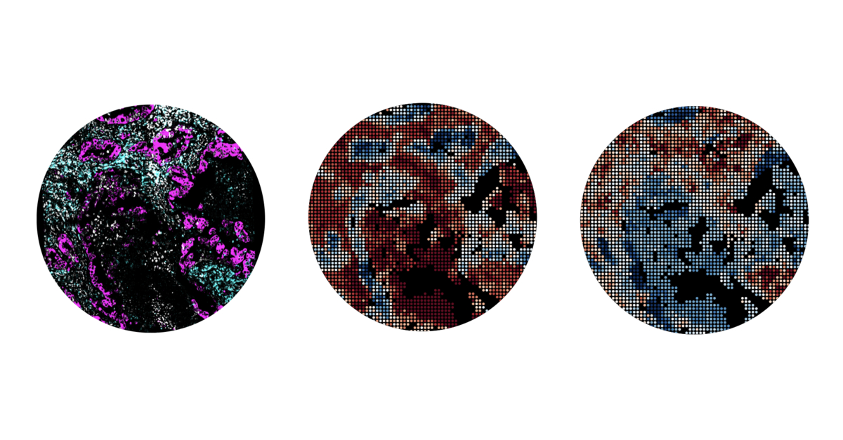 Noetik Announces First-in-Class Human Foundation Models for Discovery ...