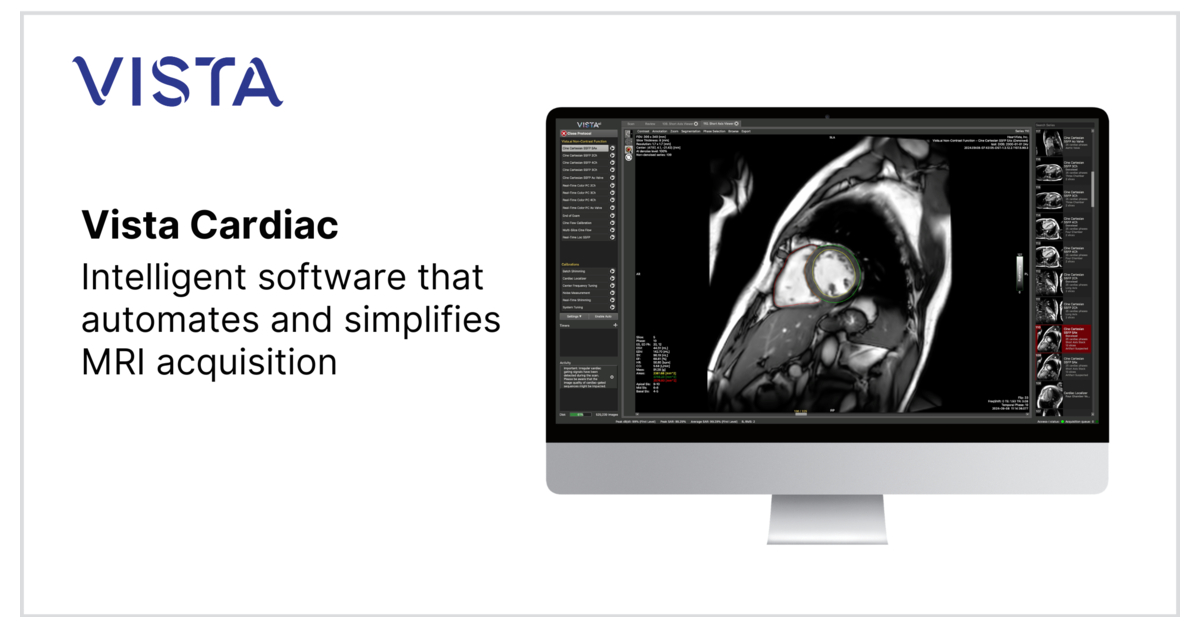 Two-Year Data Proves Vista Cardiac Delivers Faster, More Reliable MRI ...