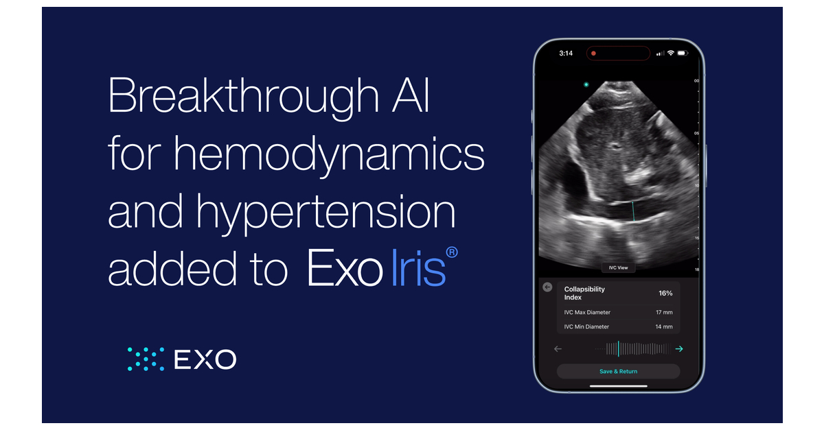 Breakthrough AI for Hemodynamics and Hypertension Added to Exo Iris® | Business Wire