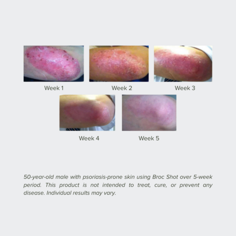 Broc Shot Becomes the First Supplement to Receive the Seal of ...