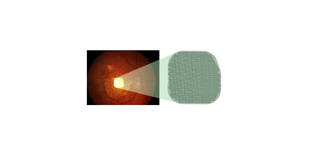 Science Corp.’s PRIMA BCI Implant Restores Functional Central Vision to ...